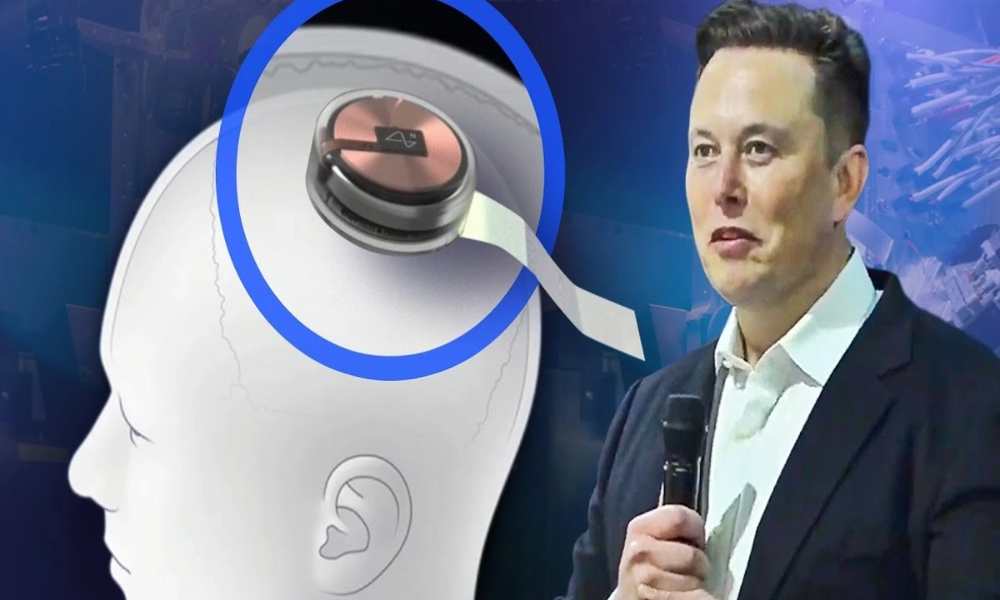 Elon Musk dice que su chip cerebral está funcionando